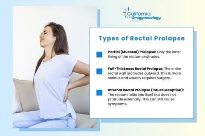 How to Fix a Rectal Prolapse? - California Urogynecology Center